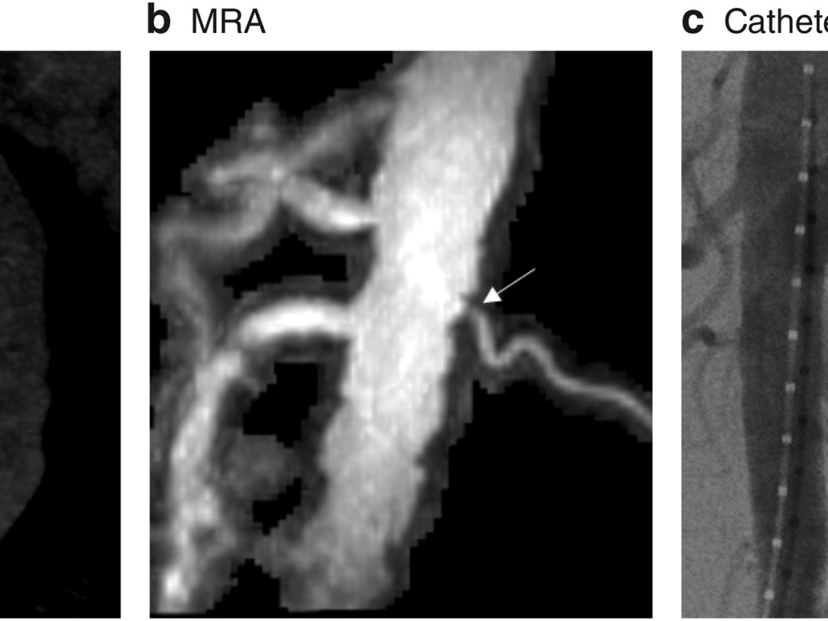 AJKD Blog – Official Blog of the American Journal of Kidney Diseases