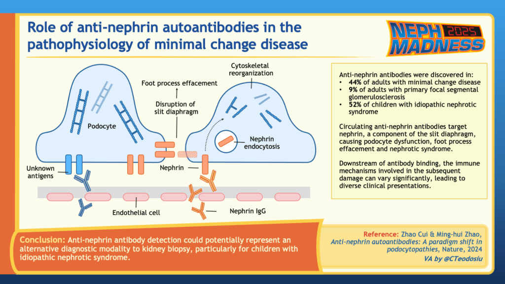 #NephMadness 2025: Minimal Change Disease Region – AJKD Blog